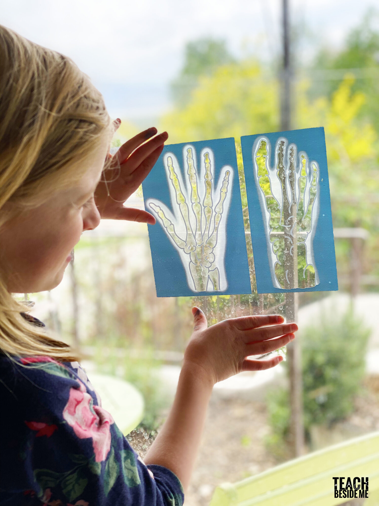Playing Doctor: DIY Doctor Play Set for Kids (With Printable X-Rays ...